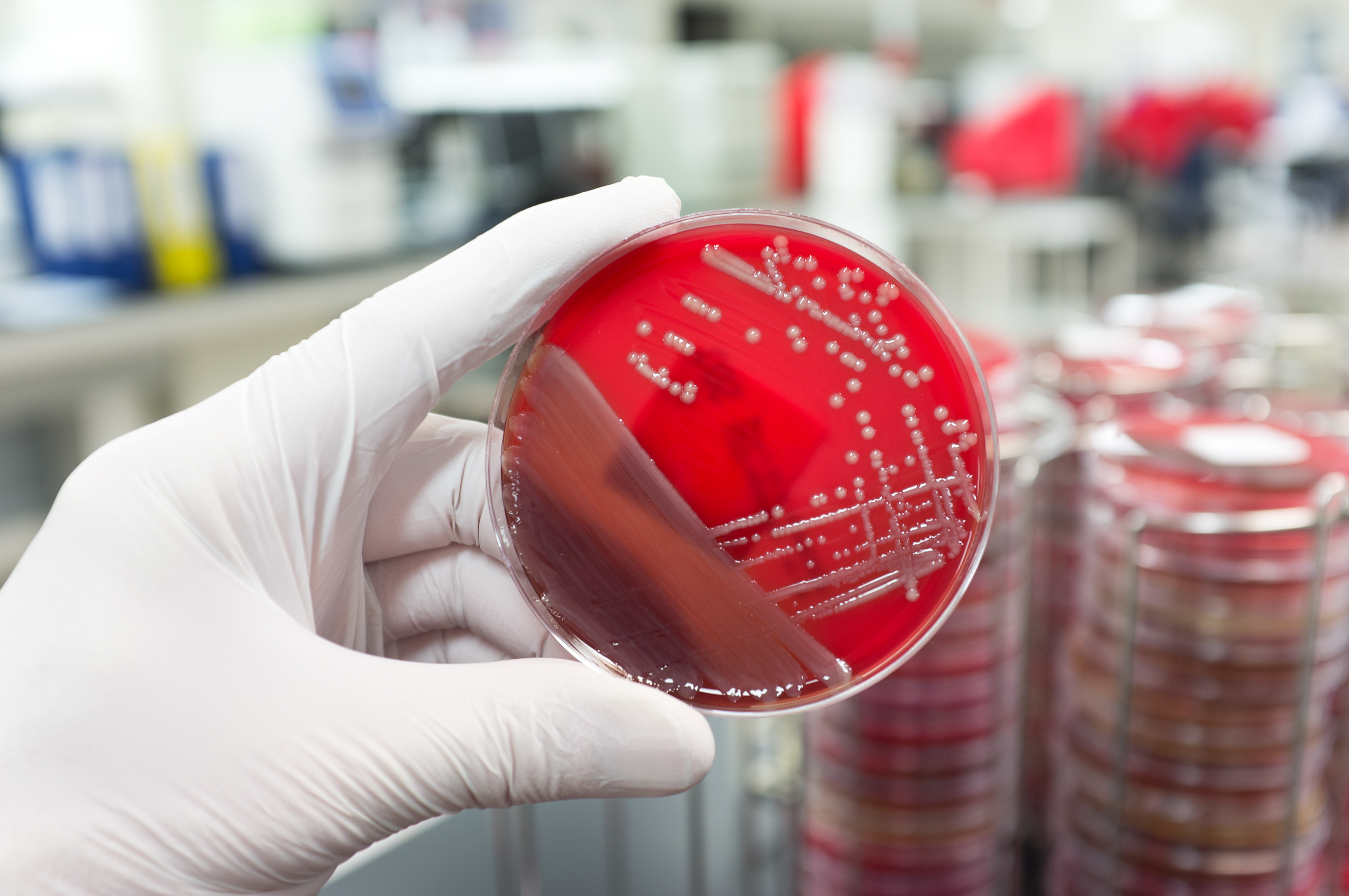 Is Cellulitis Contagious In Humans